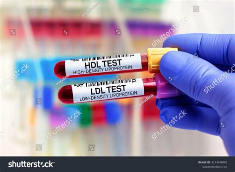 Hdl And Ldl Over Royalty Free Licensable Stock Photos Shutterstock