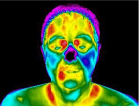 Cranial Dental Thyroid Scans Thermography Clinic Kitchener Inc
