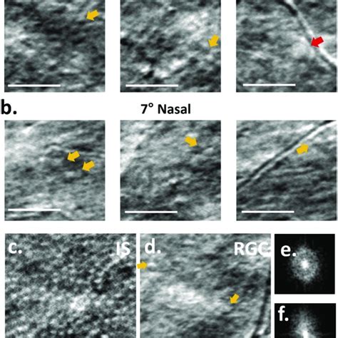 a b split detection retinal images obtained when precisely download scientific diagram