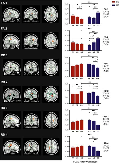 Post Hoc Analyses For Clusters With Significant Diagnosis By Genotype