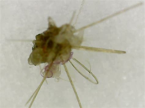 Bugs Living On My Scalp Rwhatsthisbug