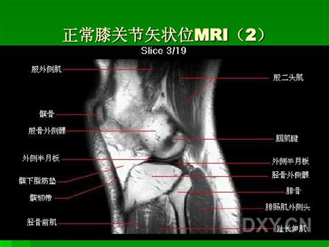 Mri Word