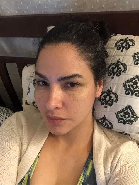 Would You Date Me R Freckledgirls