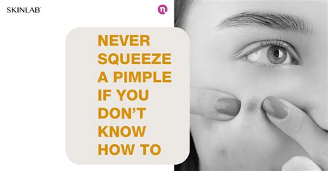 Banishing Acne Tips And Tricks For Acne Prone Skin