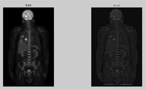 同态滤波及其实现 Csdn博客 同态滤波及其实现 Csdn博客