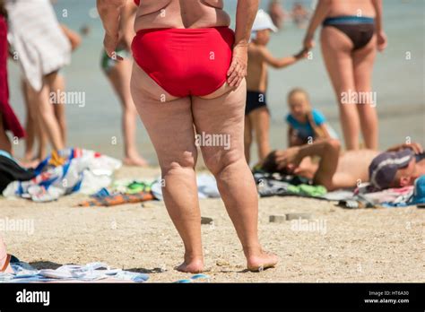 Legs Of Overweight Lady Fat Woman On The Beach Aftermath Of Poor Diet