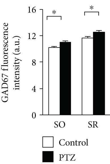 Distribution Of Vglut1 Positive And Gad67 Positive Puncta In The