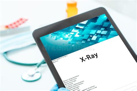 X Ray Medical Procedures A Type Of Imaging Test That Uses Radiation To Create Images Of The