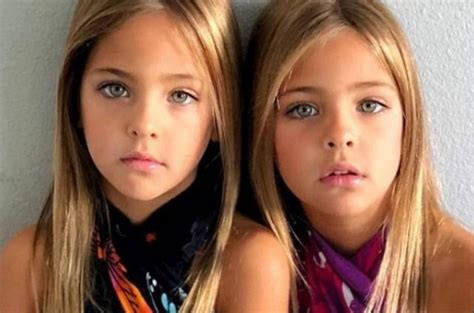 The Most Beautiful Twins In The World Their Life Many Years After Gaining Fame And Fame Pictolic