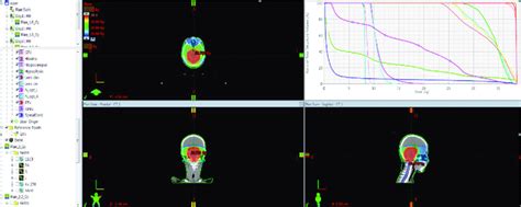 3d Conformal Radiotherapy In The Brainstem Tumor By Three Fractions Download Scientific Diagram