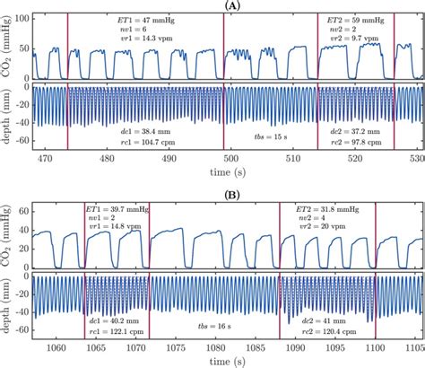 End Tidal Co2 Range Low