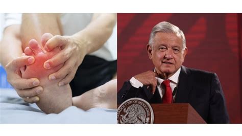 Enfermedad De La Gota Qué Es Y Cuáles Son Los Síntomas De La Enfermedad Que Padece Amlo