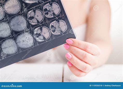 Female See Xray Photo Stock Photo Image Of Brain Physician