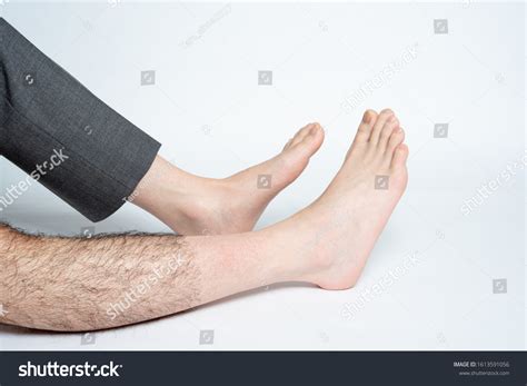 Legs Hair Removal Men Before After Stock Photo Shutterstock