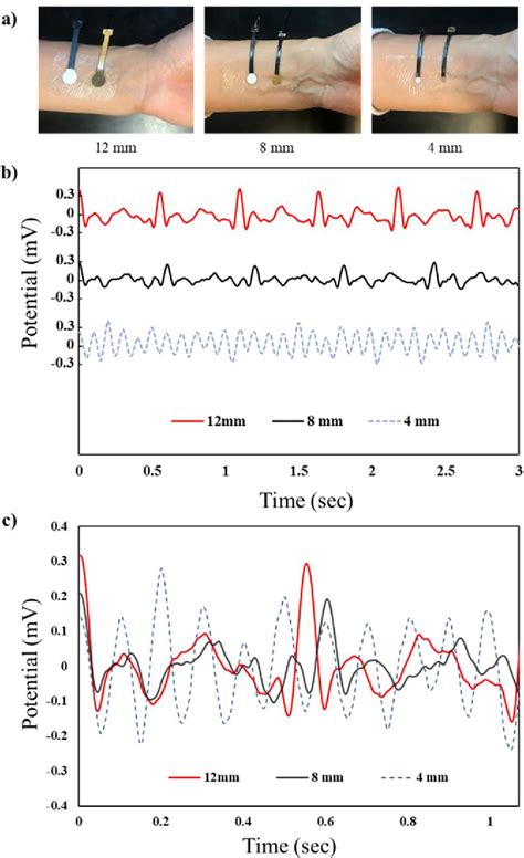 A Low Cost Flexible Wrist Ecg Sensor For Wearable Devices Application