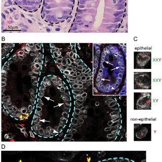 Epithelial Compartmentalization And Sex Karyotyping Of Intestinal Download Scientific Diagram