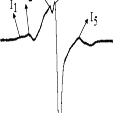 a the epr spectrum of 15 kgy irradiated ace sample b simulation of the