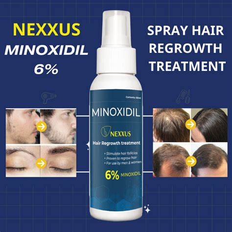Authentic Minoxidil Strands Age Of Beauty Ph