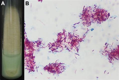 Mycobacterium Phlei Gram Stain