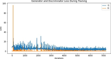 automatic detection of myocardial infarction with artificial