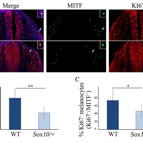 Pdf Sox10 Regulates Skin Melanocyte Proliferation By Activating The
