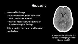 What Does A Migraine Look Like On A Ct Scan Ct Scan Machine A