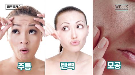 피코토닝과 클라리티토닝으로 기미를 싹 Youtube