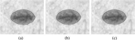 Figure 1 From Improving The Robustness Of Cell Nucleus Segmentation Semantic Scholar