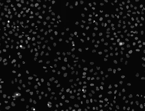 Hands On Voronoi Segmentation Voronoi Segmentation Imaging