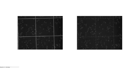 Image Processing Cell Counting And Property Analysis Using Matlab With A Bright Grid Overlay