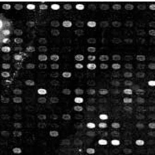 A Scanned Microarray Image And Four Example Spots Which Demonstrate