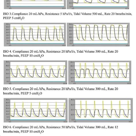 Ranges Of Values For Performance Of The Ventilator Download Scientific Diagram
