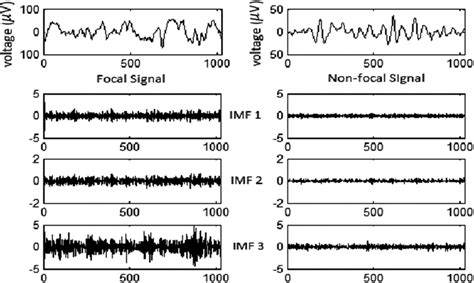 Illustration Of Focal And Nonfocal Eeg Signals Download Scientific Diagram