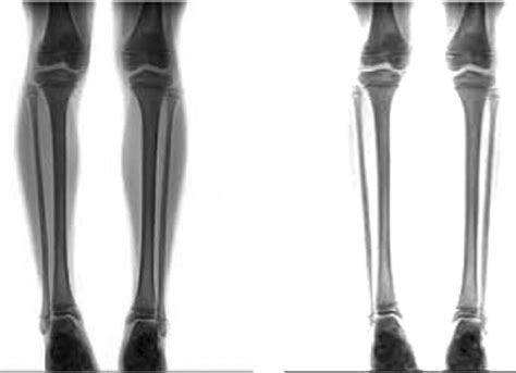 The Outcome Of Applying The Bounded Sum Operator With The Proposed Manner Download Scientific