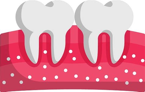상아질 펄프 또는 근관 벡터 색상 아이콘 디자인 치과 기호 의료 기호 치과 기구 스톡 일러스트레이션 치수 구멍 개념 건강관리와 의술에 대한 스톡 벡터 아트 및 기타 이미지