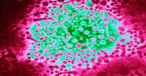 Brit Scientists Find Oldest Human Virus Ever Discovered Lurking