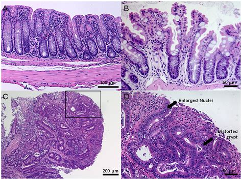 Colon Histology