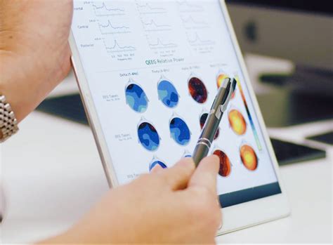 EEG Report Brain Treatment Oklahoma