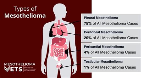 What Mesothelioma Types Affect Veterans