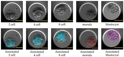 Breast Development Time Lapse 