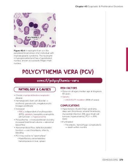 Polycythemia Vera Nord Osmosis