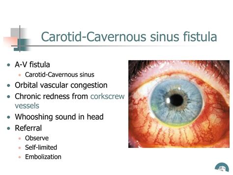 Ppt Ophthalmology For Primary Care Providers Powerpoint Presentation