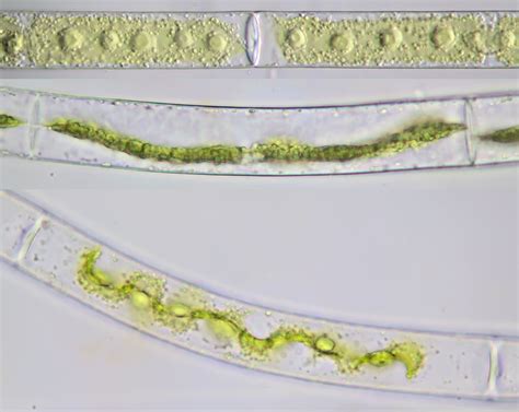 Filamentous Green Algae Microscopy Of Nature