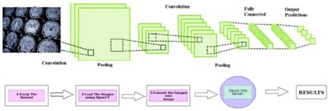 Diagnostics Free Full Text Hybrid Deep Learning Approach For
