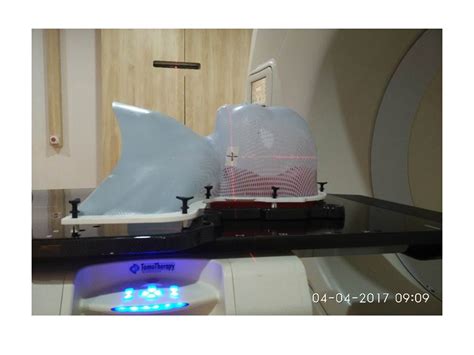 Frameless Stereotactic Radiosurgery Fsrs Unit Pelayanan Onkologi Radiasi