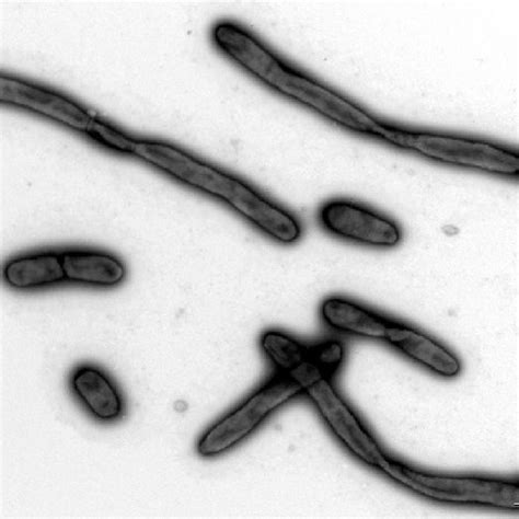 Transmission Electron Microscopy Of Chryseobacterium Phocaeense Strain