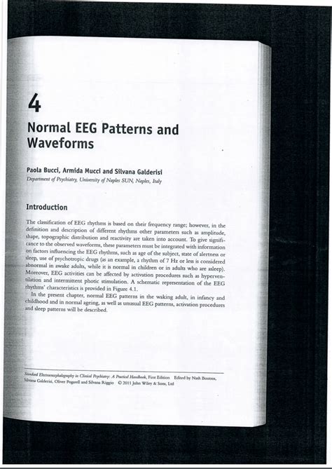 PDF Normal EEG Patterns And Waveforms