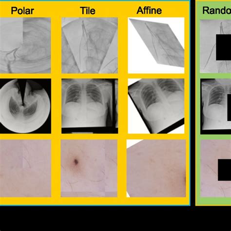 Examples Of Nonlinear Transformations Three Image Examples From Download Scientific Diagram