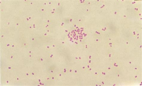 Fluxograma De Diplococos Gram Negativos Cocos Gram Negativos De