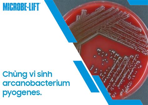 Ứng Dụng Công Nghệ Fbr Trong Xử Lý Nước Thải Microbe Lift